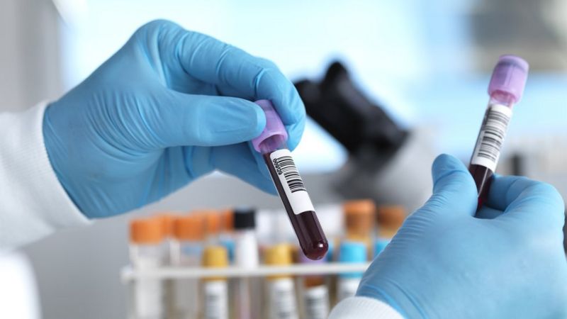 » Kan testi ile kansere erken teşhis umudu